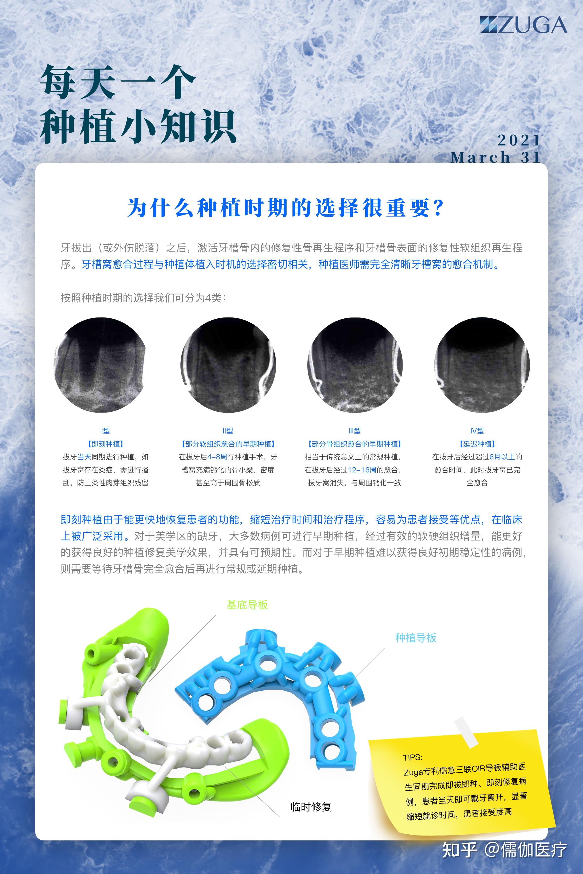 每天一个种植小知识 知乎