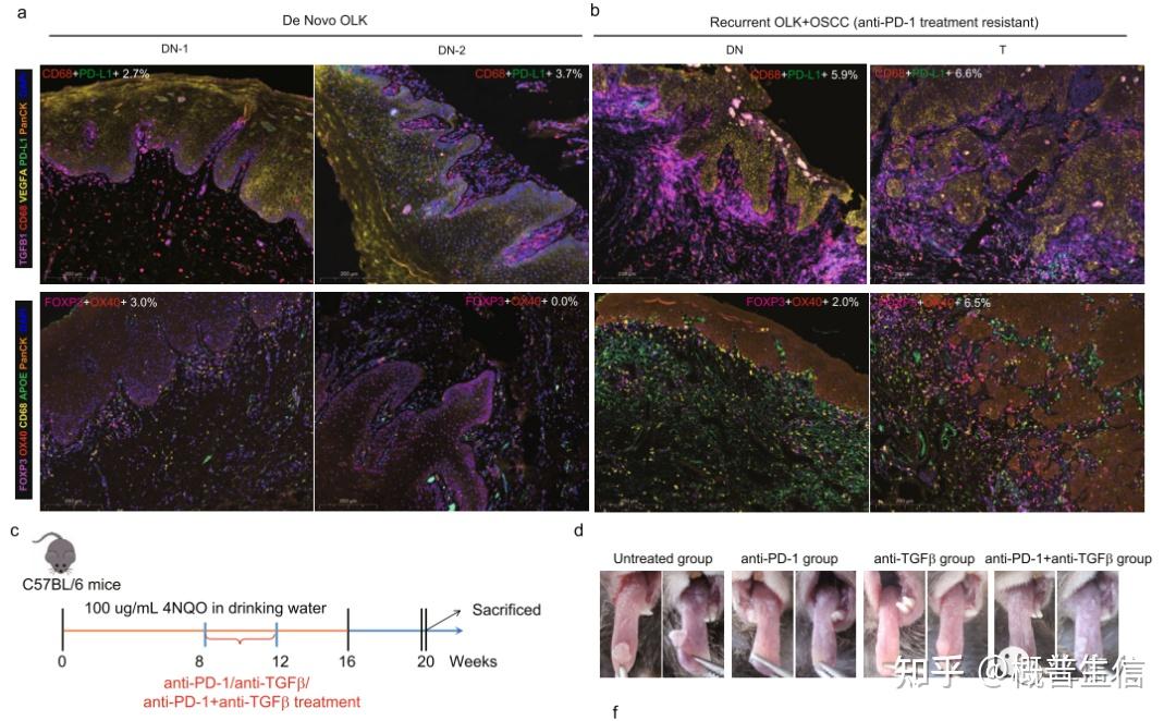 从生信的视角揭示癌症的前世今生 — 癌前病变篇 - 知乎