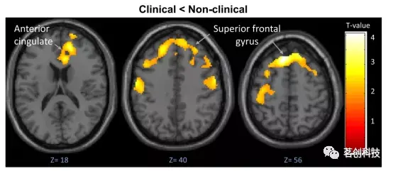 Nature子刊 | 你知我意：精神病人的威胁性评估的fMRI标志物 - 知乎