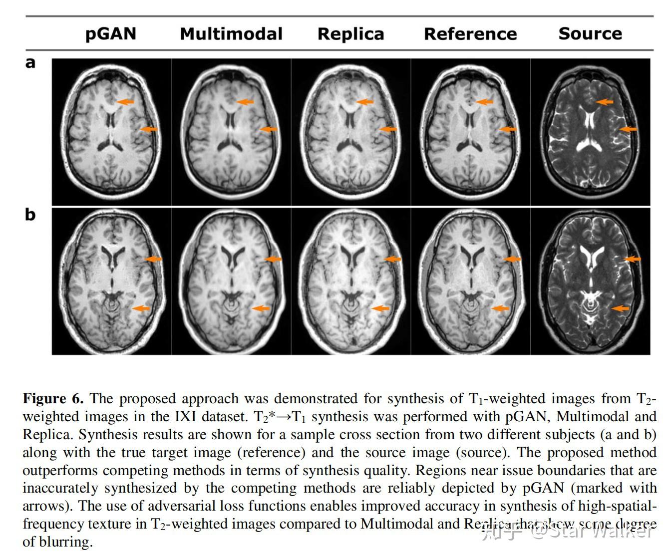 T2转T1，是无中生有，还是隐秘的角落？ - 知乎