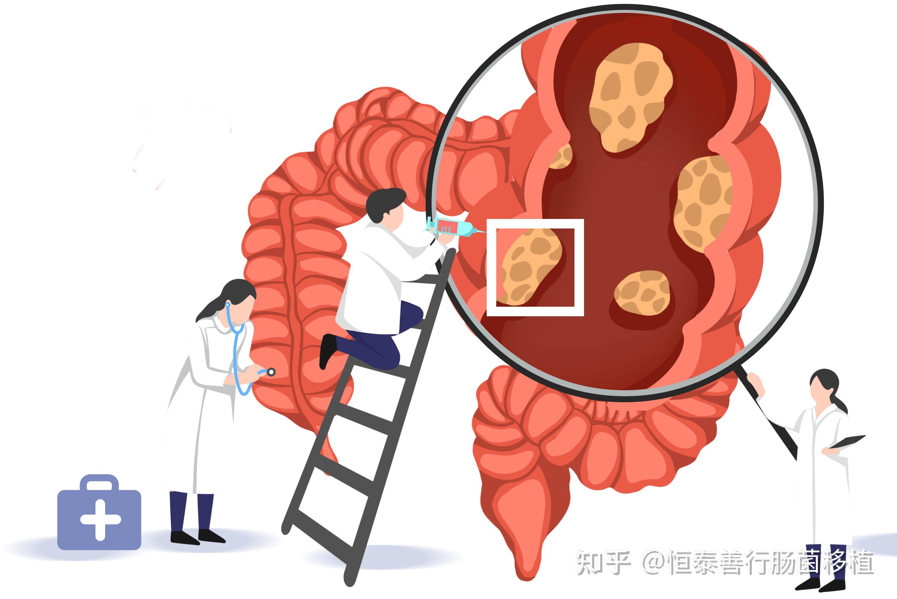 巨单胞菌属 Megamonas - 知乎