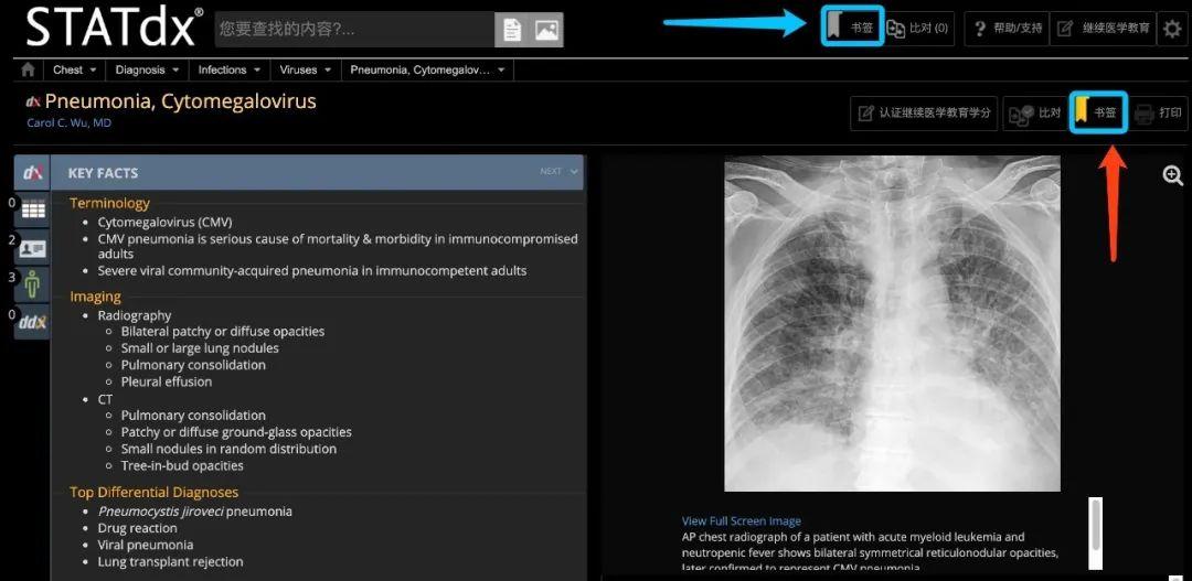 手把手教程：美国医生广泛好评的影像学工具STATdx用户指南 - 知乎