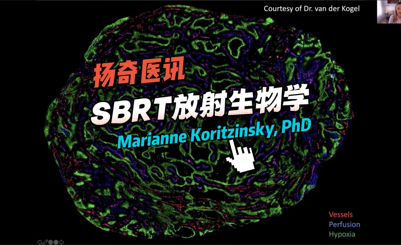扬奇智能社区｜SBRT和常规分割不同的放射生物学效应 - 知乎