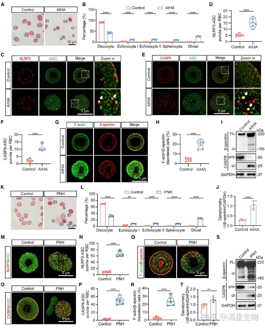 Cell(IF=45.5) HyCyte细胞助力科研—揭示NLRP3炎症小体介导溶血性细胞死亡新机制 - 知乎