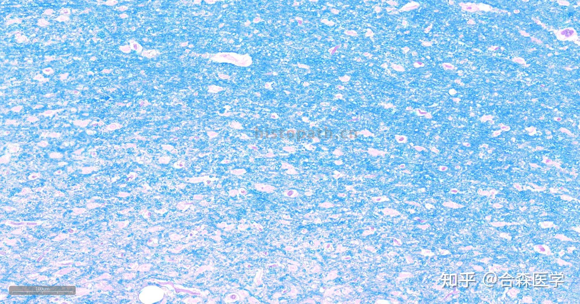 Luxol Fast Blue髓鞘染色 - 知乎