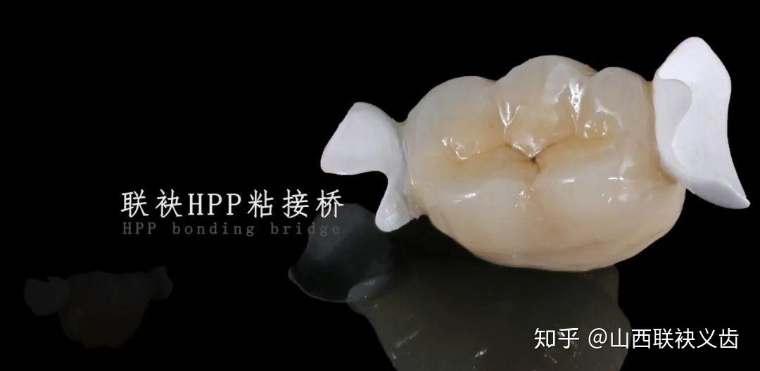 口腔医生在使用新材料HPP之前，应该知道的适应症 - 知乎