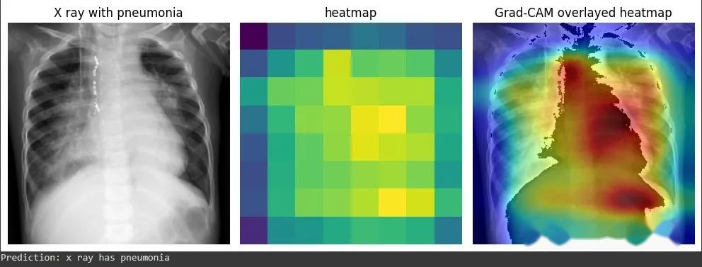 实践教程｜Grad-CAM的详细介绍和Pytorch代码实现 - 知乎
