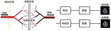 动脉自旋标记灌注MR成像(ASL-MRI) - 知乎