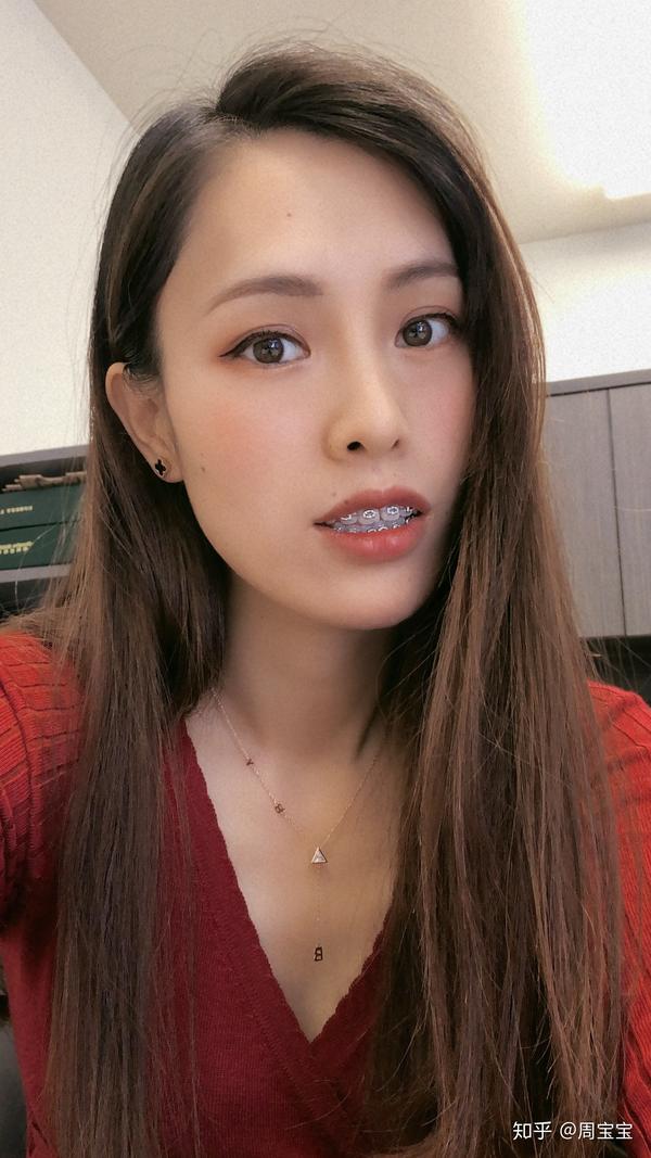 33岁牙套妹 知乎
