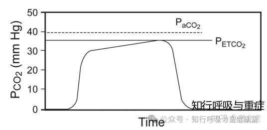 呼末二氧化碳监测原理、方法、影响因素及临床应用 第162期 - 知乎