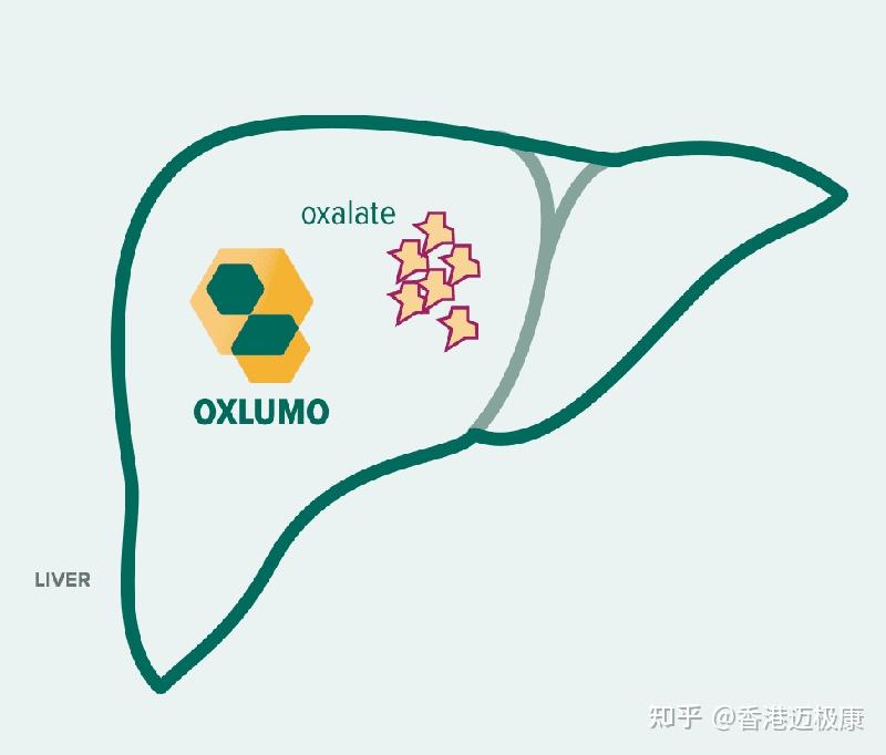 香港迈极康 | Oxlumo(lumasiran)获批治疗晚期原发性高草酸尿症1型以降低UOx和POx水平 - 知乎