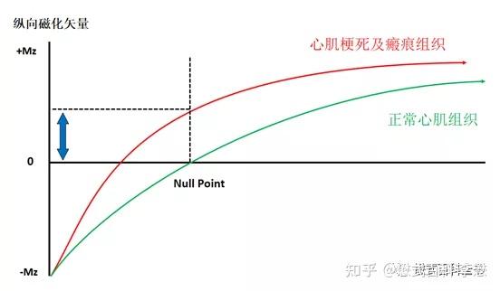 PSIR序列原理及临床应用 - 知乎