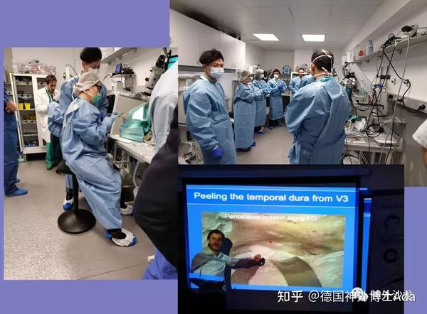 法国巴黎第七大学 Lariboisière 医院Sebastien Froelich教授颅底学习见闻 - 知乎