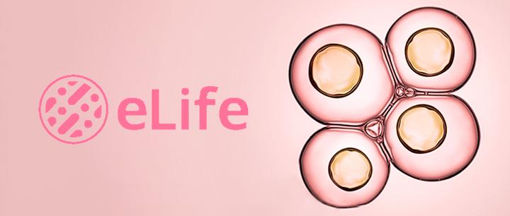 eLife | 蛋白质组学揭示造血干细胞转录后蛋白抑制机制 - 知乎