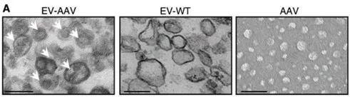 AAV递送新途径：当细胞外囊泡遇到AAV - 知乎