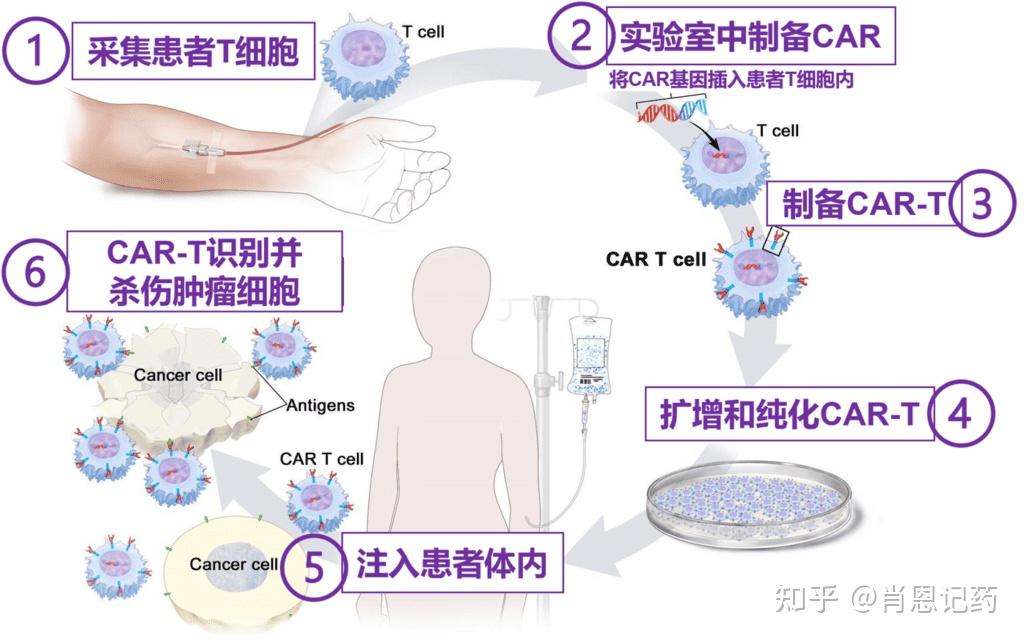 记住FDA生物药 | 2款BCMA CAR-T | idecabtagene vicleucel，西达基奥仑赛 | 多发性骨髓瘤 - 知乎