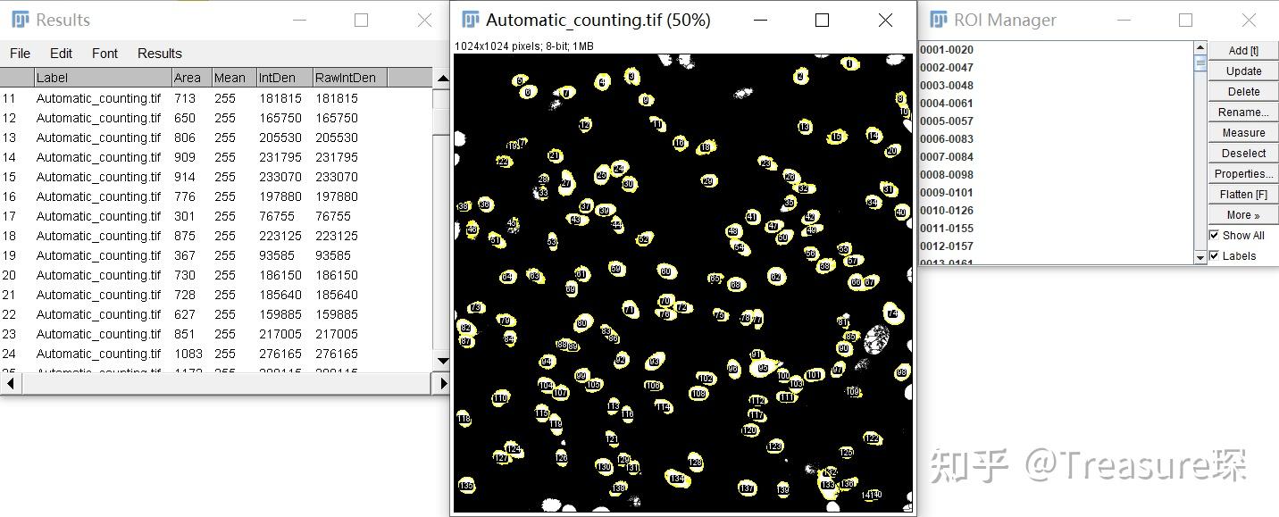 ImageJ实用技巧——自动细胞计数(解放双手篇) - 知乎