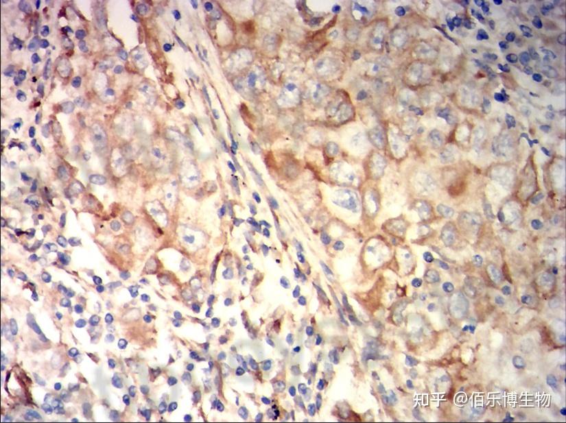 佰乐博生物蛋白抗体——炎症标志物之纤维蛋白原（Fibrinogen） - 知乎