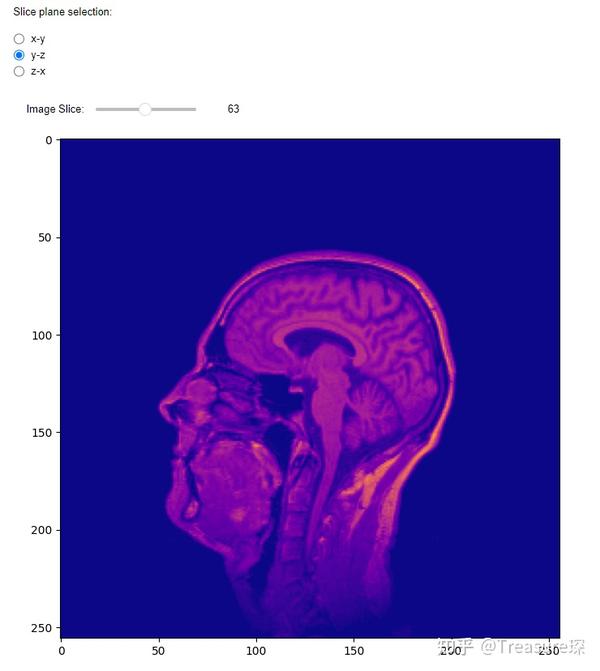 Python科研图像处理——Slice Viewer - 知乎