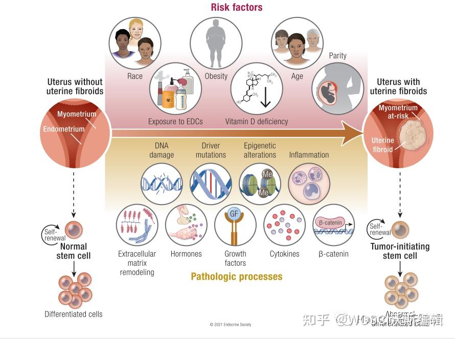 【22年8月】妇产科科上个月最受关注SCI论文解析 丨 早期筛检的生物标记物备受重视 - 知乎