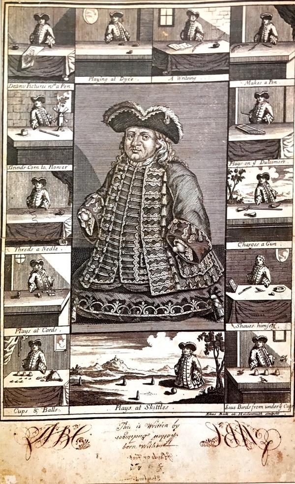 他天生没有手脚，但他是名留青史的魔术师：Matthew Buchinger - 知乎