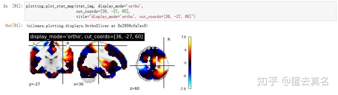 nilearn 笔记（6） - 知乎