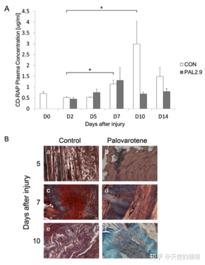 软骨衍生的视黄酸敏感蛋白（CD-RAP）：（FOP）异位软骨内骨化（HEO）的阶段特异性生物标志物。 - 知乎