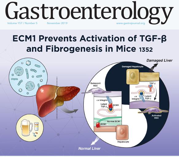 Gastroenterology | 南模生物助力揭示ECM1在肝纤维化疾病进展中的调控机制和功能 - 知乎