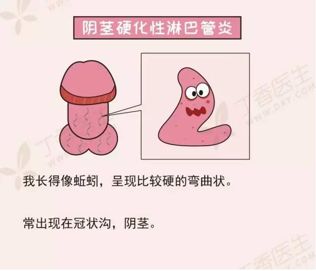 【解惑】丁丁上的小点点，什么东东？ 知乎 