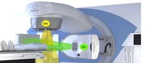 MRIdian Linac 磁共振引导放疗系统介绍 - 知乎