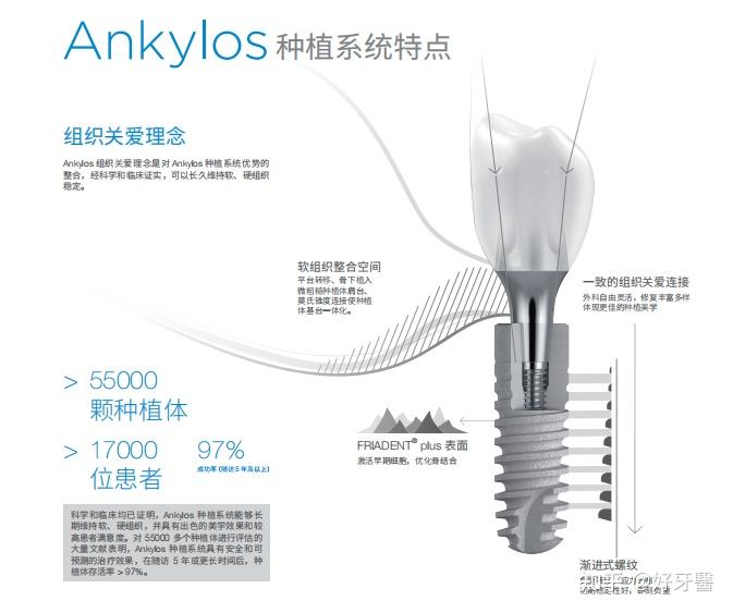德国费亚丹FRIADENT Ankylos种植系统介绍 - 知乎