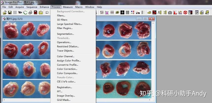 TTC染色详细计算分析过程，步骤详解（组图） - 知乎