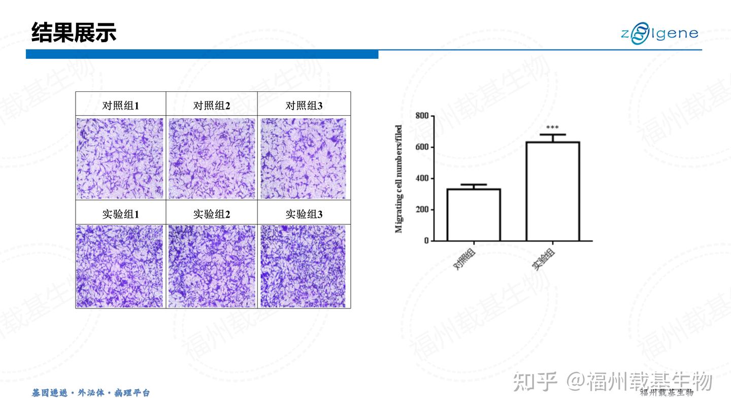 细胞Transwell迁移实验操作教程 - 知乎