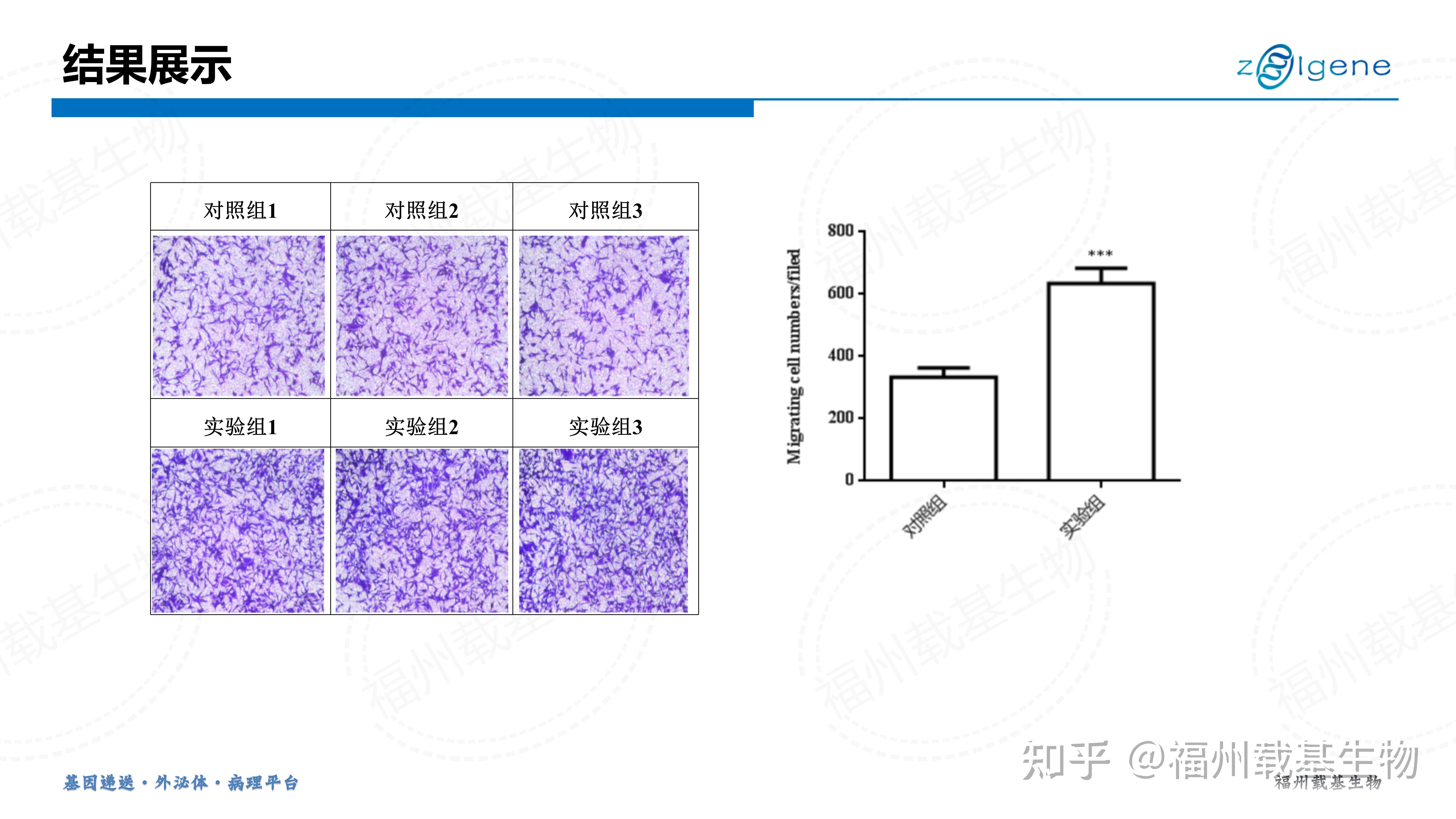 细胞Transwell迁移实验操作教程 - 知乎