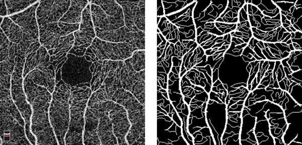 ROSE 数据集介绍 - 知乎