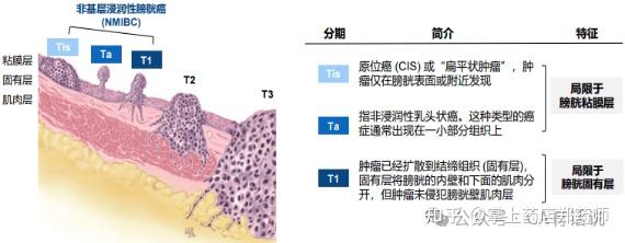 新型给药系统TAR-210（含厄达替尼） 临床研究：高风险和中风险NMIBC患者的无复发生存率和完全缓解率均为90%！ - 知乎