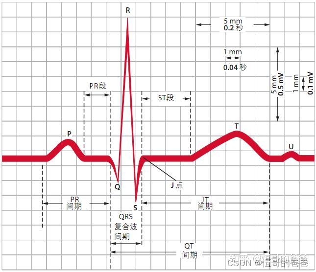 静态心电设备的数据采集（aECG） - 知乎