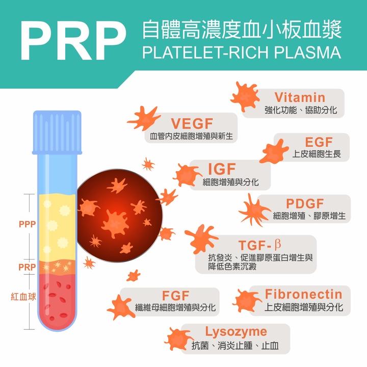 韩国（WOOMCHAN）永长植发 PRP头发注射管理 - 知乎