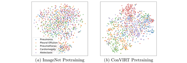 [论文笔记]ConVIRT: Contrastive Learning of Medical Visual Representations ...