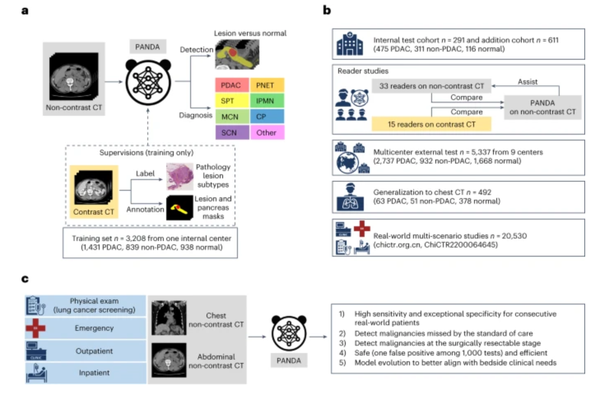 【AI与癌症早筛】CT平扫实现胰腺癌早期筛查 - 知乎