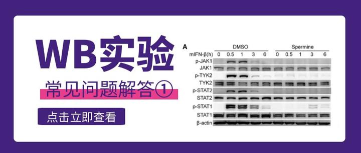 WB实验中常见的问题与其解答 - 知乎