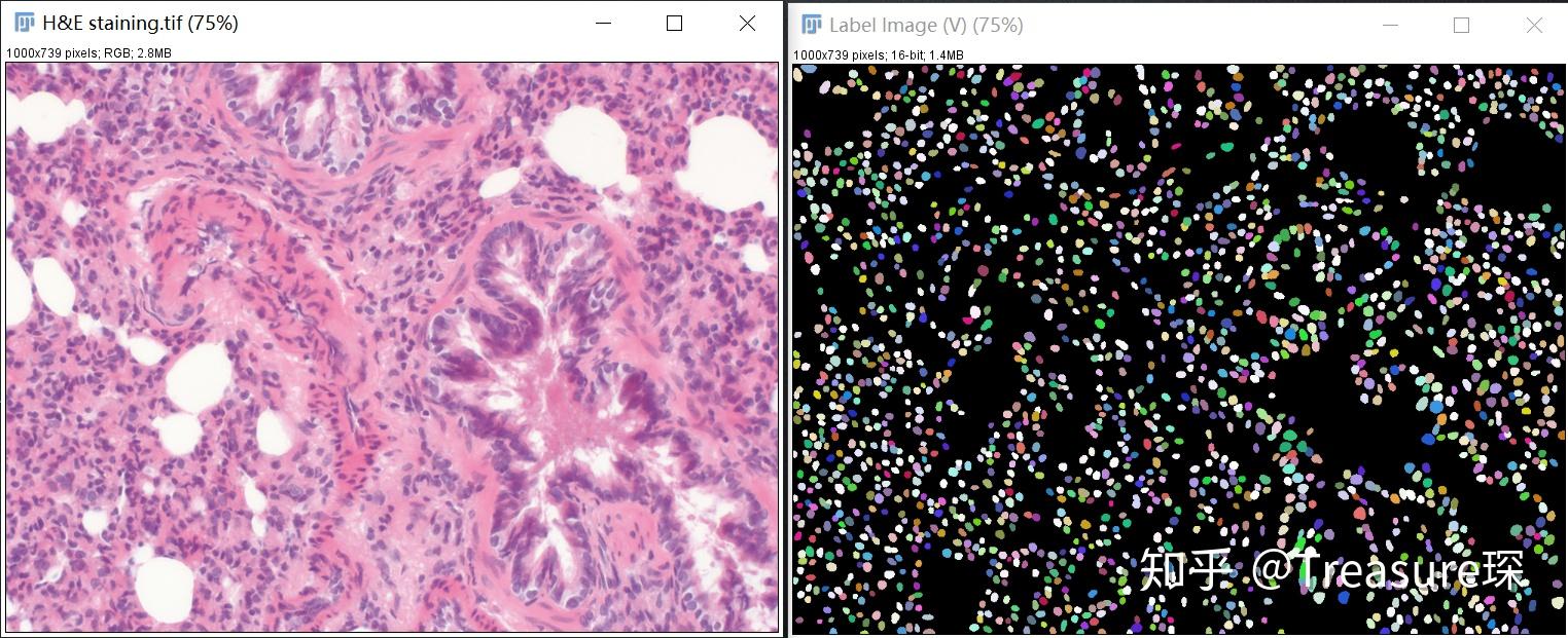 ImageJ实用教程——基于深度学习的细胞核自动分割（插件篇） - 知乎
