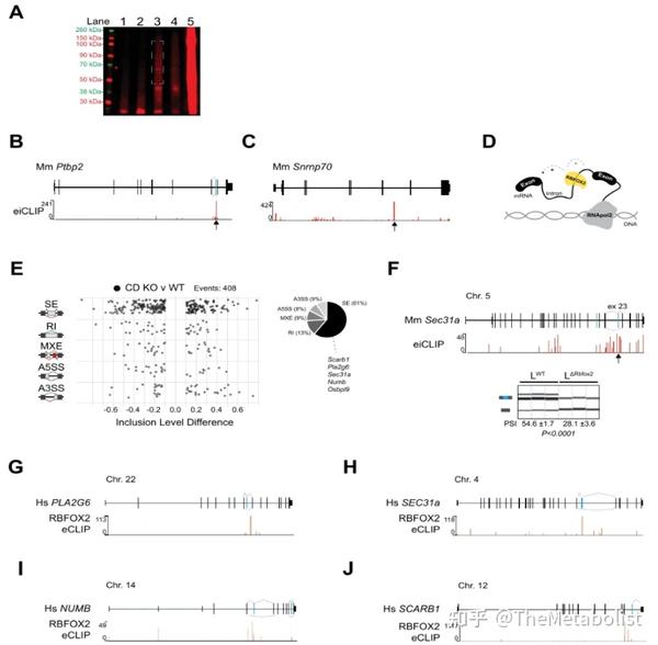 代谢学人--Nature Metabolism：胆固醇代谢紊乱，RBFOX2来理清 - 知乎