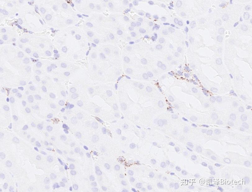巨噬细胞M1.M2，历时2年硬干货分享. - 知乎