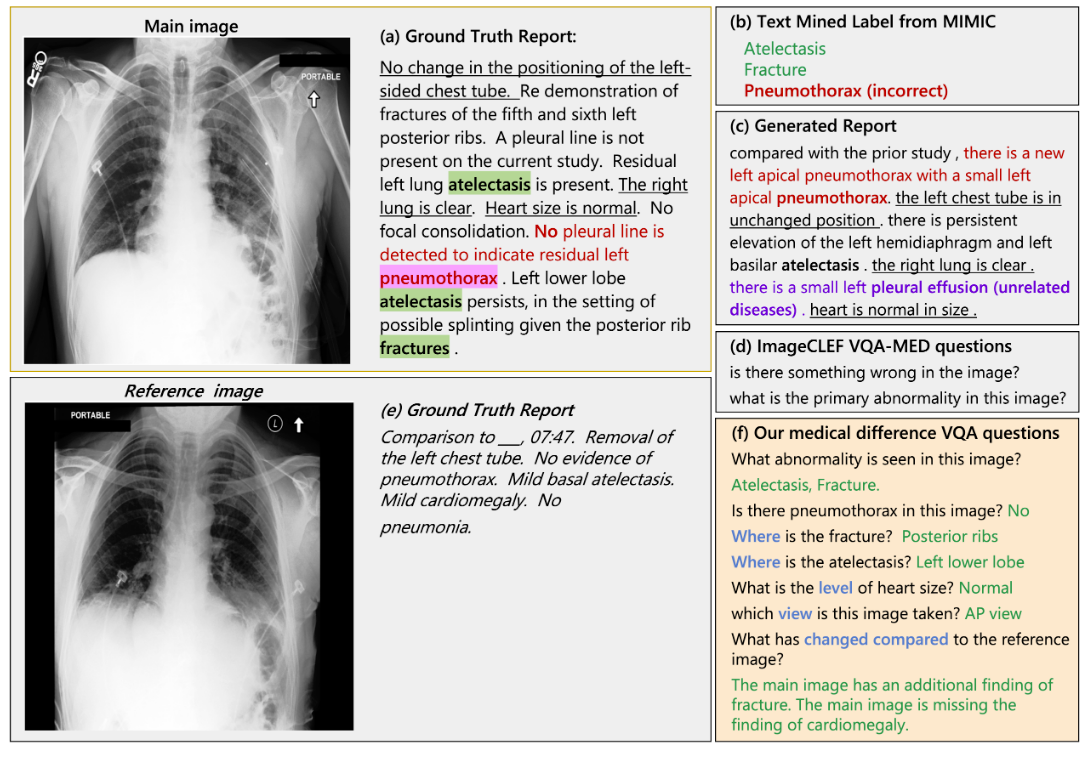 MIMIC-Diff-VQA 胸部X光图像差异视觉问答数据集介绍 - 知乎
