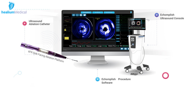 基于血管内超声的RDN代表性产品一览 - 知乎