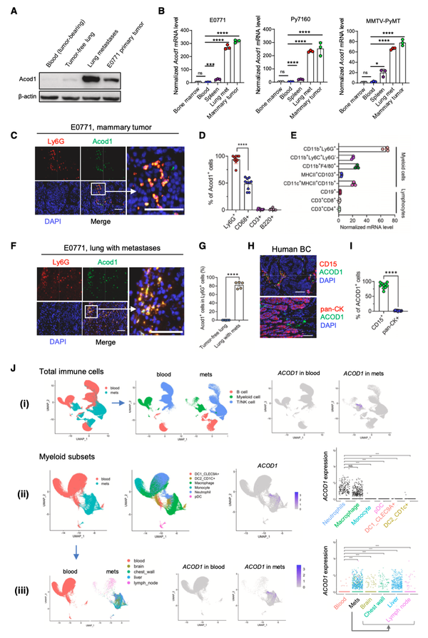 Cell Metabolism丨中性粒细胞通过ACOD1抵抗铁死亡并促进乳腺癌转移 - 知乎