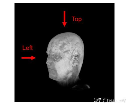 ImageJ实用教程——3D Stack Reslice(基本功能篇) - 知乎