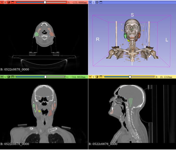 PDDCA数据集介绍 - 知乎