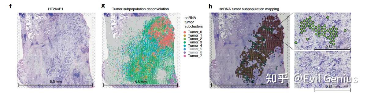单细胞空间联合分析方法之文献运用篇 - 知乎